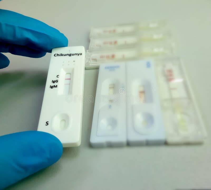 Chikungunya IgG, IgM Rapid Screening Test, Showing Positive IgG Result ...