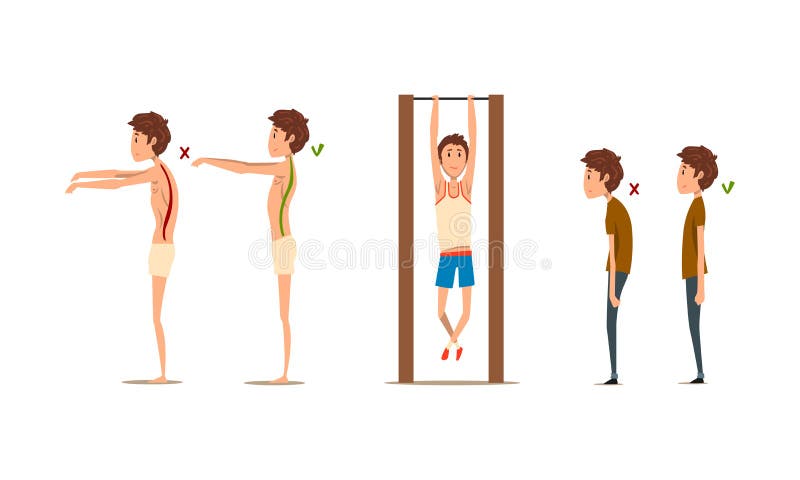 Teen Boy Demonstrating Wrong and Correct Spine Posture Vector Set Stock ...