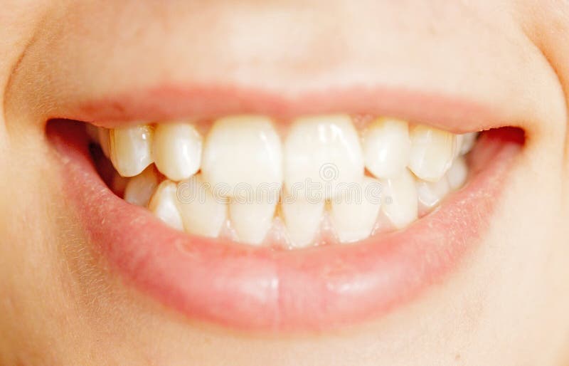 Teeth stock photo. Image of equipment, dental, smile - 18542512