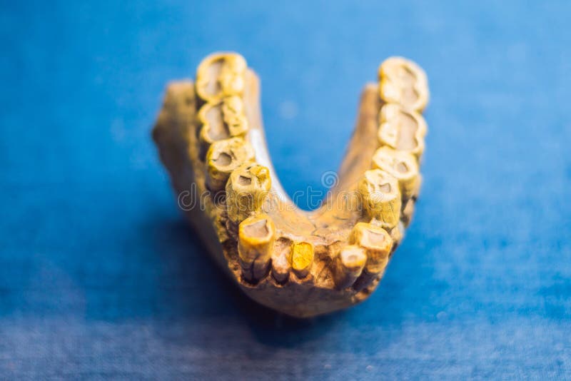 Teeth of an Ancient Man. Human Evolution is the Evolutionary Process ...