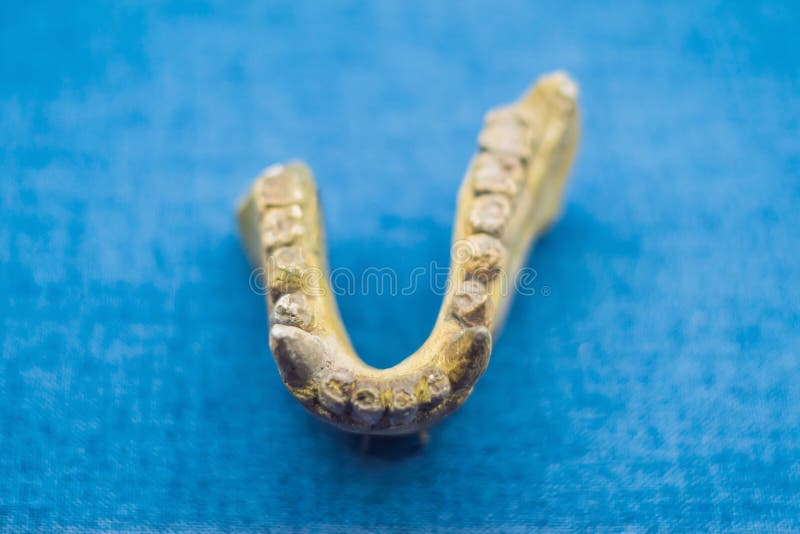 Teeth of an Ancient Man. Human Evolution is the Evolutionary Process ...