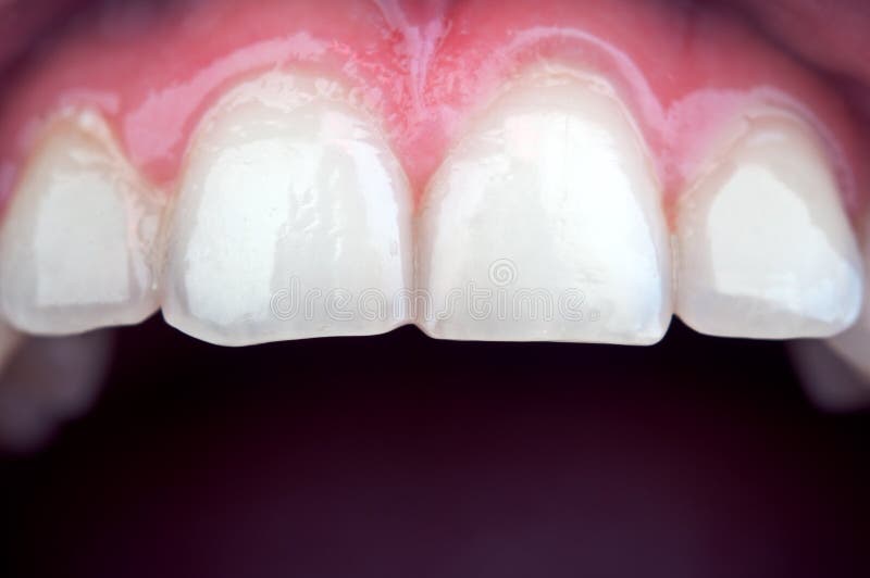 Teeth background stock photo. Image of dental, medical - 29187826