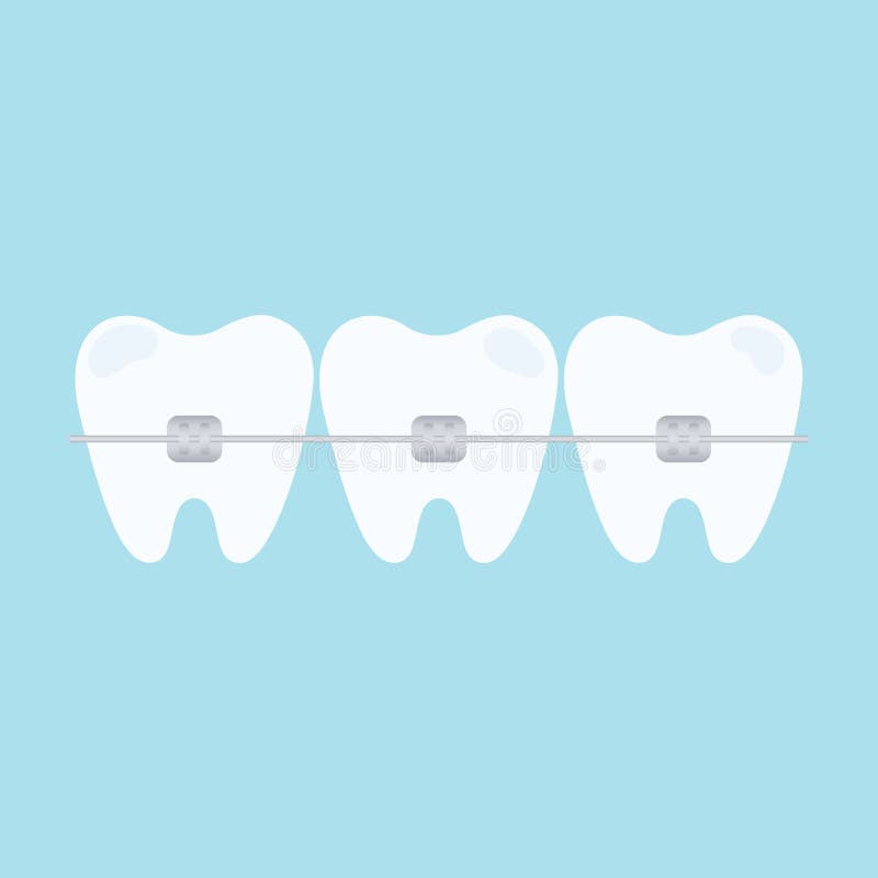 Teeth with Braces. Dental Braces. Orthodontic Dentistry. Vector Flat ...