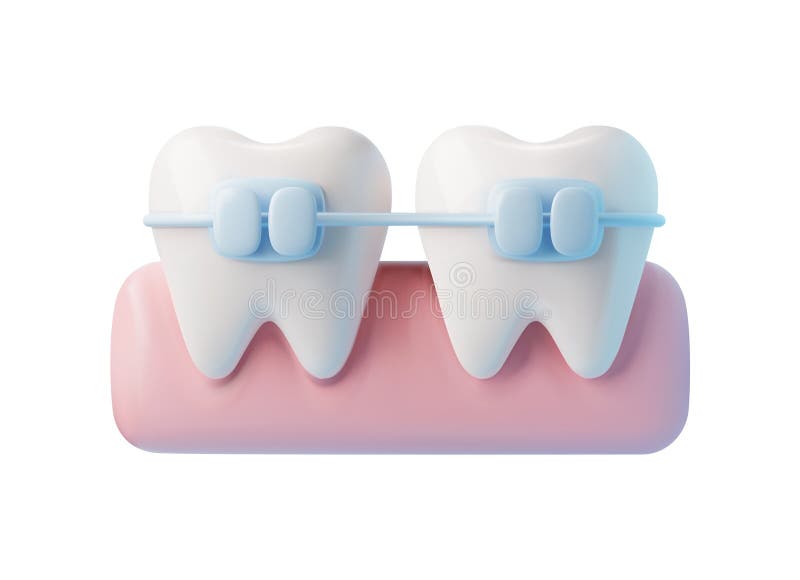 Teeth with a Bracket Frame Realistic Render Icon Vector Illustration ...