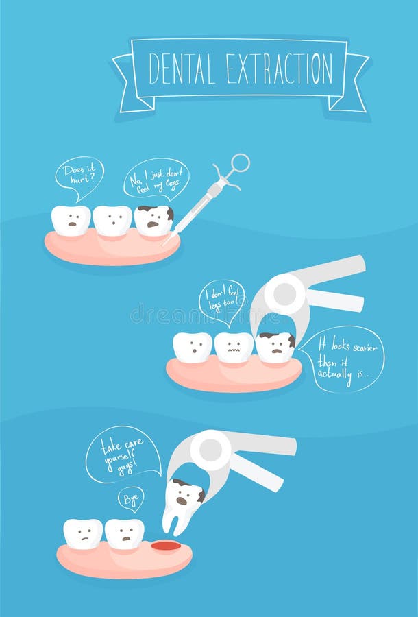 Teeth Comics about Dental Extraction, Vector Stock Vector ...
