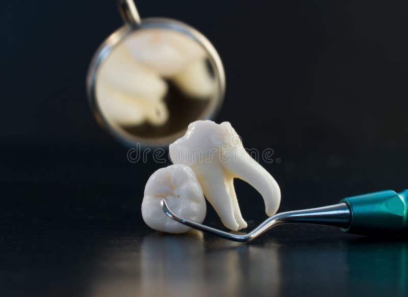 Teeth, Dental Instrumsnts and Implants Stock Photo - Image of ...