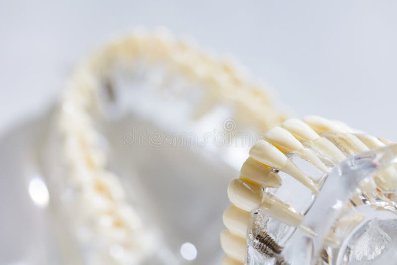 Teeth Education Model. Shallow Dof Stock Image - Image of orthodontist ...