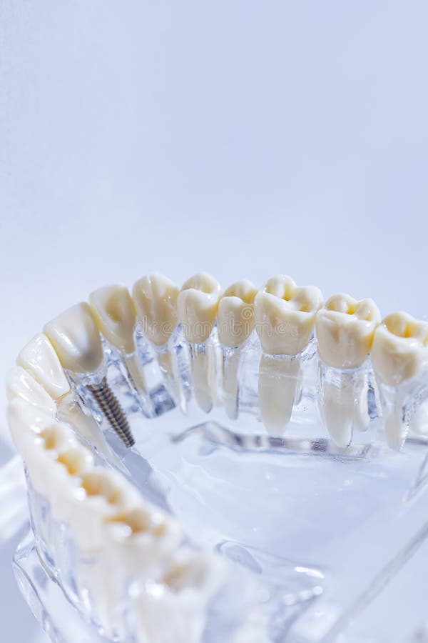 Teeth Education Model. Shallow Dof Stock Image - Image of closeup ...