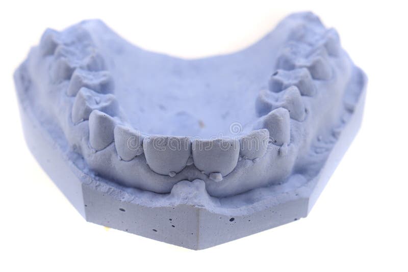 Teeth Gypsum Model Isolated Stock Image - Image of orthodontist ...
