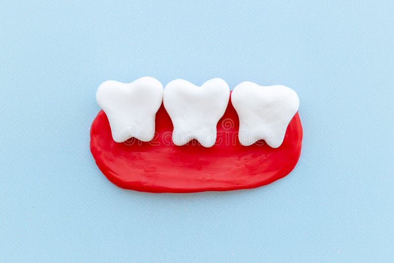 Teeth Health and Dental Care. Teeth Models with Caries or Plaque Stock ...