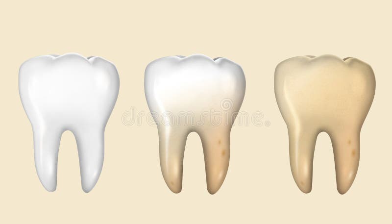 Teeth mock-up set stock vector. Illustration of tooth - 190616503