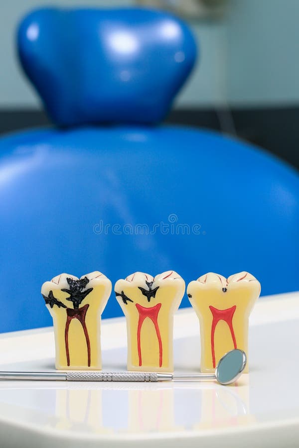 Teeth model stock image. Image of details, dentist, probe - 67541771