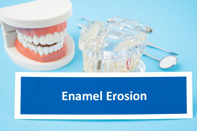 The Teeth Model and Enamel Erosion Dental Disease with Tools Dental on ...