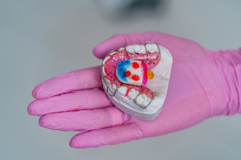 Teeth Model on Hand on Blurred Background. Plastic Teeth in One Row ...