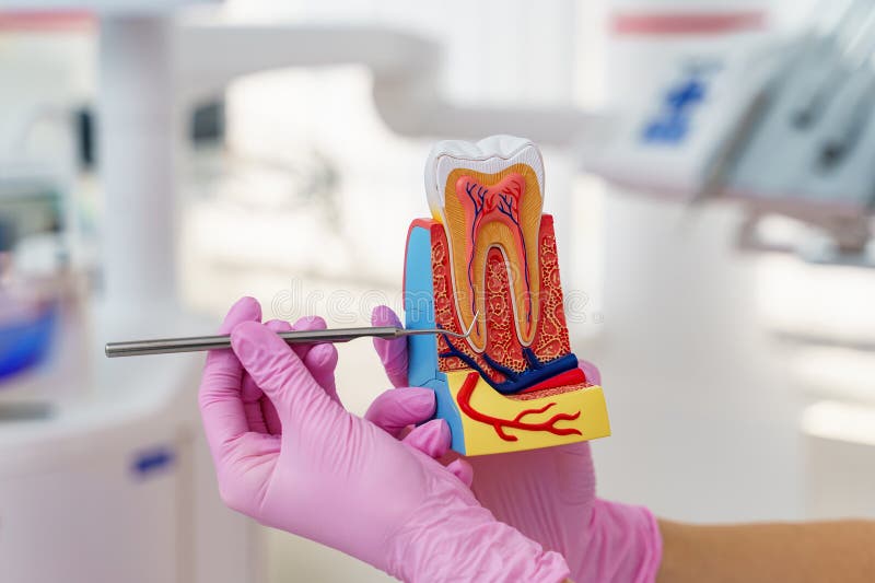 Teeth Model on Hand on Blurred Background. Plastic Teeth in One Row ...