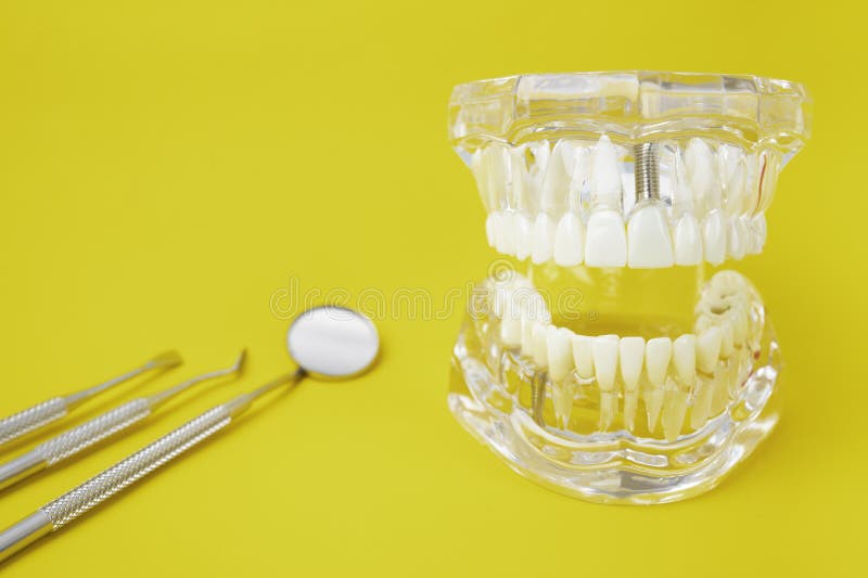 The Teeth Model and Instrument Dental on Yellow Background Stock Image ...
