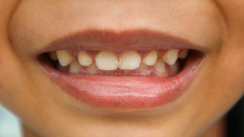 The Teeth and Mouth of a Child Stock Photo - Image of growing ...