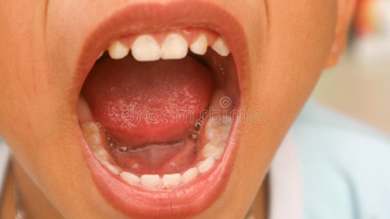 The Teeth and Mouth of a Child Stock Photo - Image of alone, childhood ...