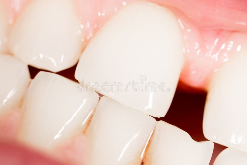 Man's Mouth As Toliet Stock Photos - Free & Royalty-Free Stock Photos ...