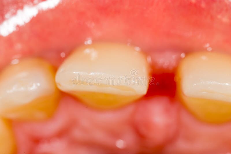 Man's Mouth As Toliet Stock Photos - Free & Royalty-Free Stock Photos ...