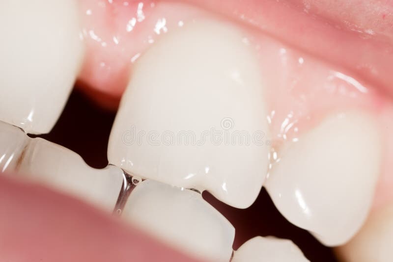 Man's Mouth As Toliet Stock Photos - Free & Royalty-Free Stock Photos ...