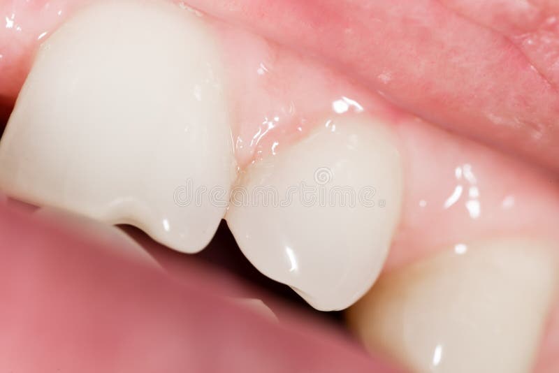 Man's Mouth As Toliet Stock Photos - Free & Royalty-Free Stock Photos ...