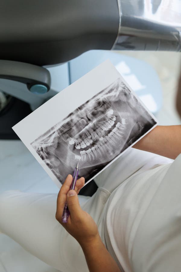 Teeth Panoramic X Ray Professional Examination. Stock Image - Image of ...