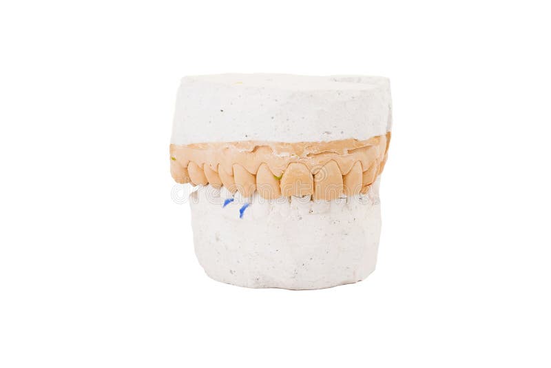 Teeth Plaster Cast. Close Up on White Background Stock Image - Image of ...