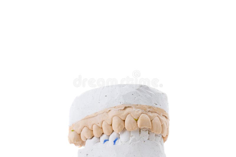 Teeth Plaster Cast. Close Up On White Background Picture. Image: 13966509