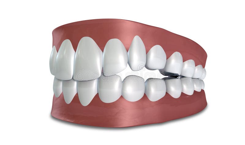 Teeth Set Closed Isolated stock photo. Image of teeth - 46627204