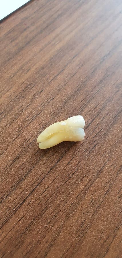 Teeth single real one stock photo. Image of leaf, fruit - 243554806