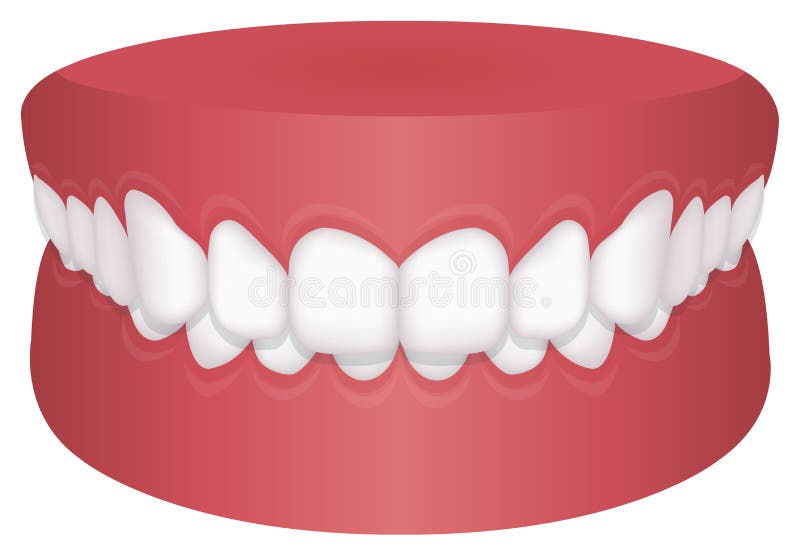 Teeth Trouble Bite Type / Crooked Teeth Vector Illustration /Open Bite ...