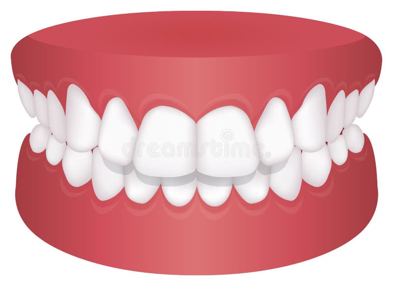 Teeth Trouble Bite Type Vector Illustration //Overbite Back Teeth Stock ...