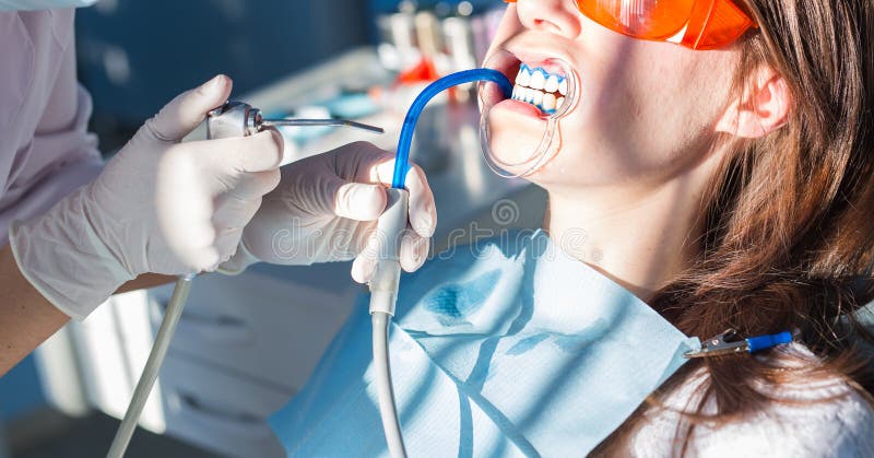 Teeth Whitening Procedure Close-up Stock Image - Image of checkup, lamp ...