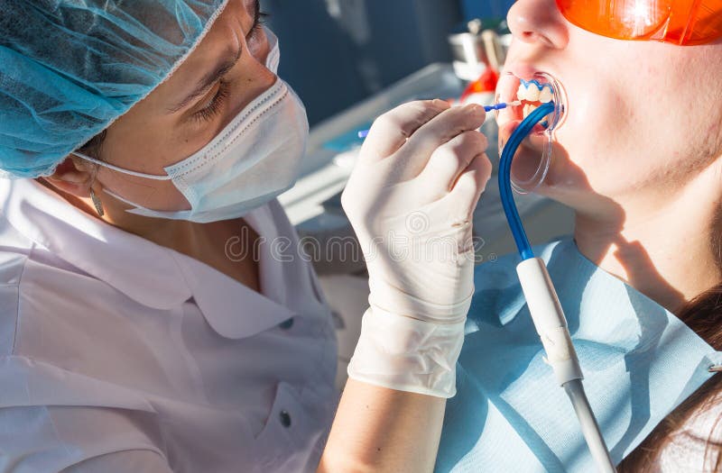 Teeth Whitening Procedure Close-up Stock Photo - Image of human, doctor ...