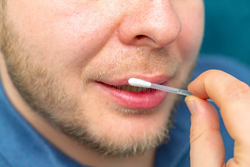 Teeth whitening procedure stock photo. Image of mouth - 144784948