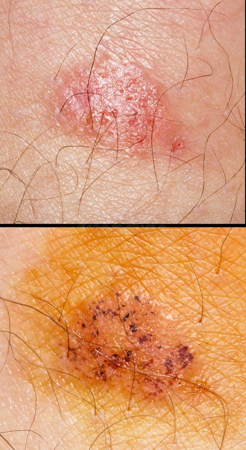 1,363 Teigne Photos libres de droits et gratuites de Dreamstime