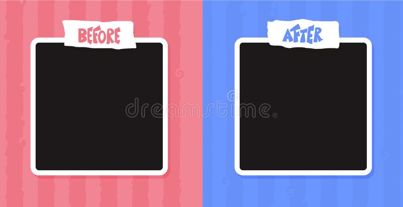 Before and after Template. Vector Illustration Stock Vector ...