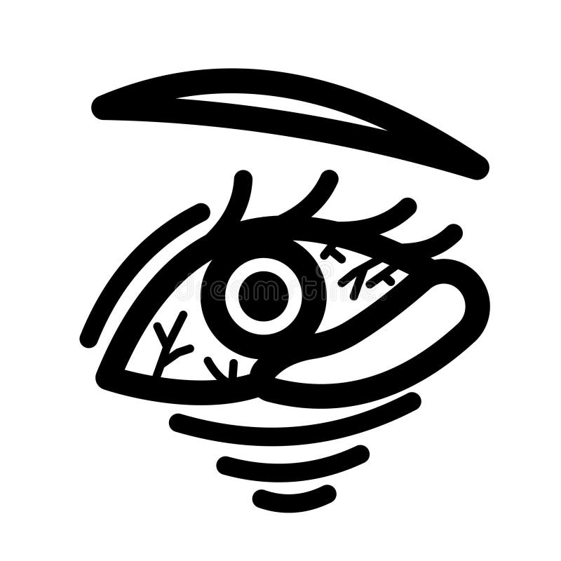 Eye irritation vector icon stock vector. Illustration of irritation ...
