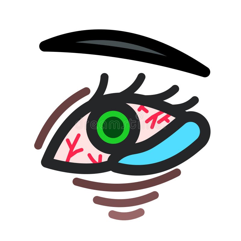 Red Eye Irritation Vector Icon Colored Stock Vector - Illustration of ...