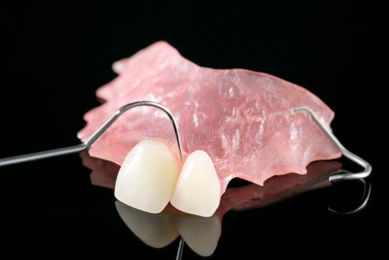 Temporary Denture and Dental Tools. Stock Image - Image of front ...