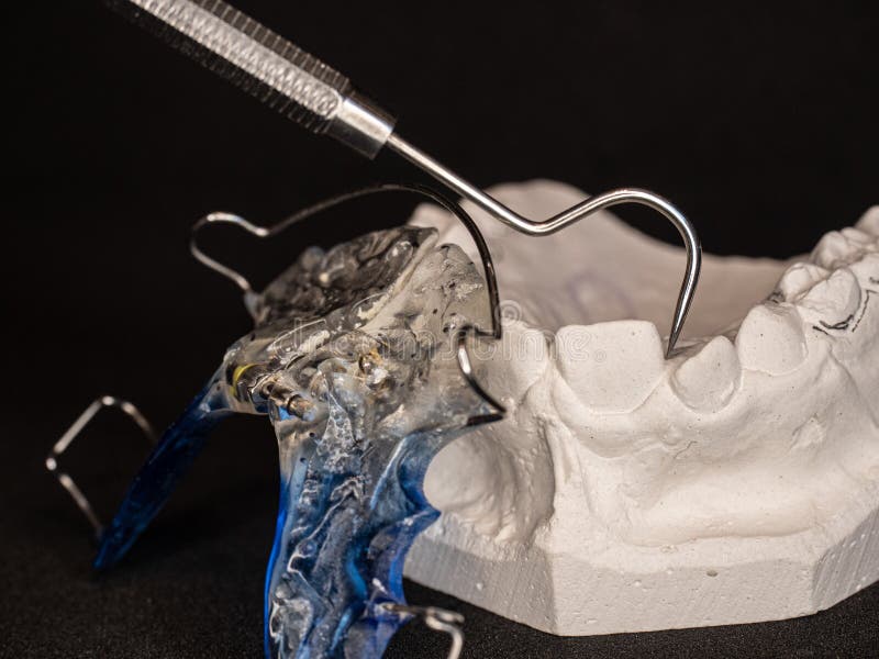 Temporary Retainers on White Plaster Cast Stock Image - Image of ...