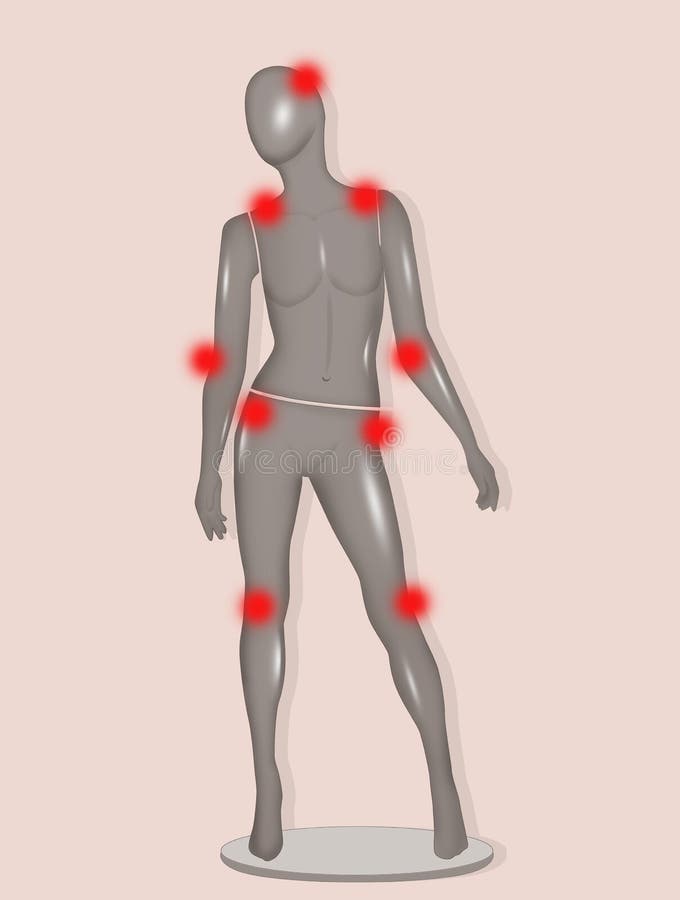 Tender Points of Fibromyalgia Stock Illustration - Illustration of ...