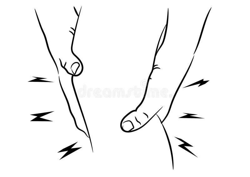 Tendon Knee Joint Problems Painful, Swelling after from Exercise Vector ...