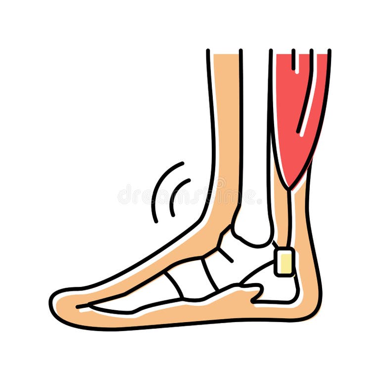 Tendonitis Icon Stock Illustrations – 227 Tendonitis Icon Stock ...
