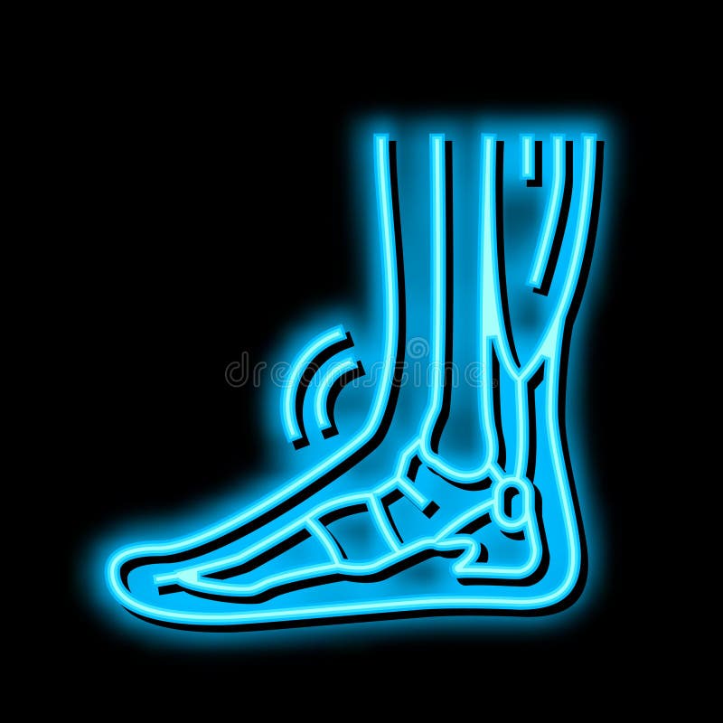 Tendonitis Problem Neon Glow Icon Illustration Stock Vector ...