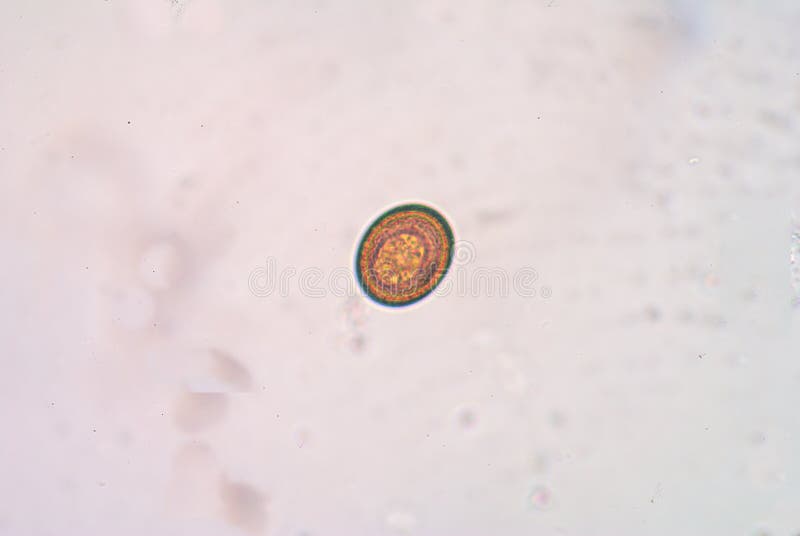 La Tenia Del Cane (echinococcus Granulosus), Verme Di Idatide ...
