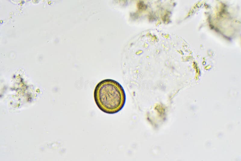 Tenia imagen de archivo. Imagen de fecal, platija, paciente - 93433191