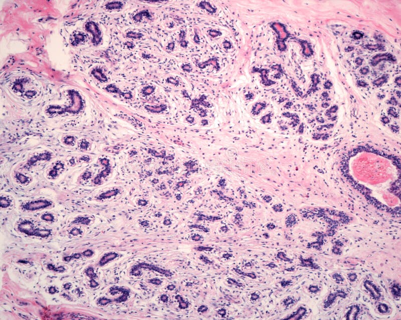 Human mamary gland. TDLU stock image. Image of epithelium - 232081731