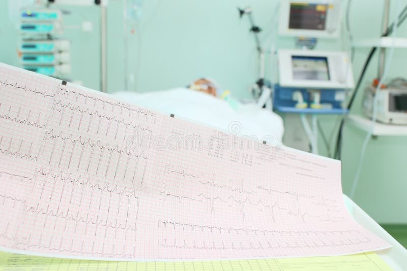 Test of Heart Activity in Patient Ward Stock Photo - Image of ...